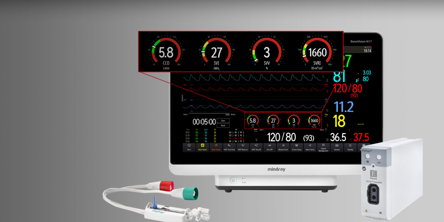 Mindray Company Profile: Innovating Healthcare Through Technology - medery